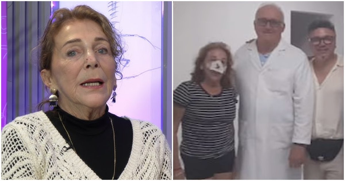 Coralita Veloz relata que sufrió un fuerte golpe en la nariz durante ...